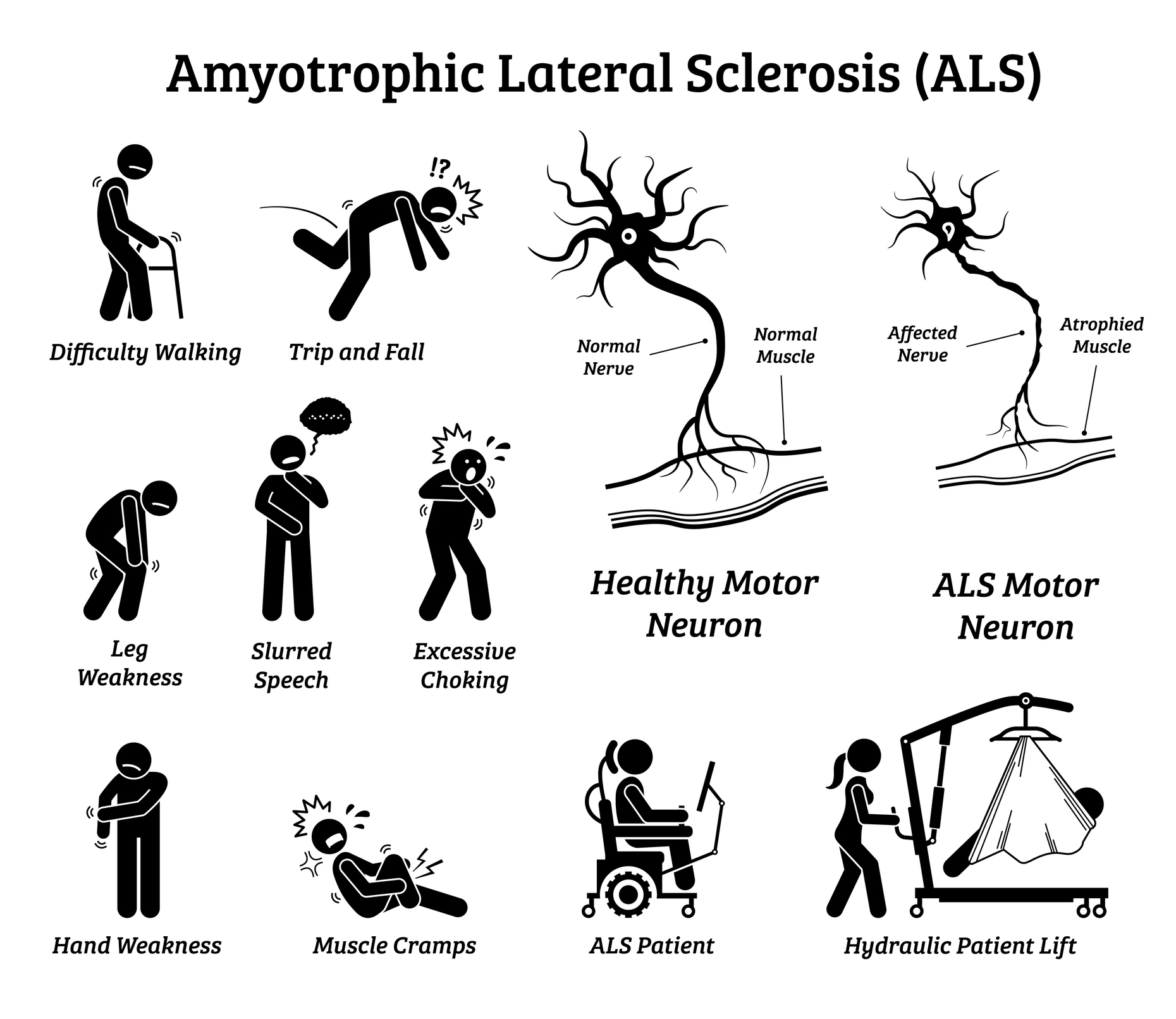 ALS Health BeatHealth Beat